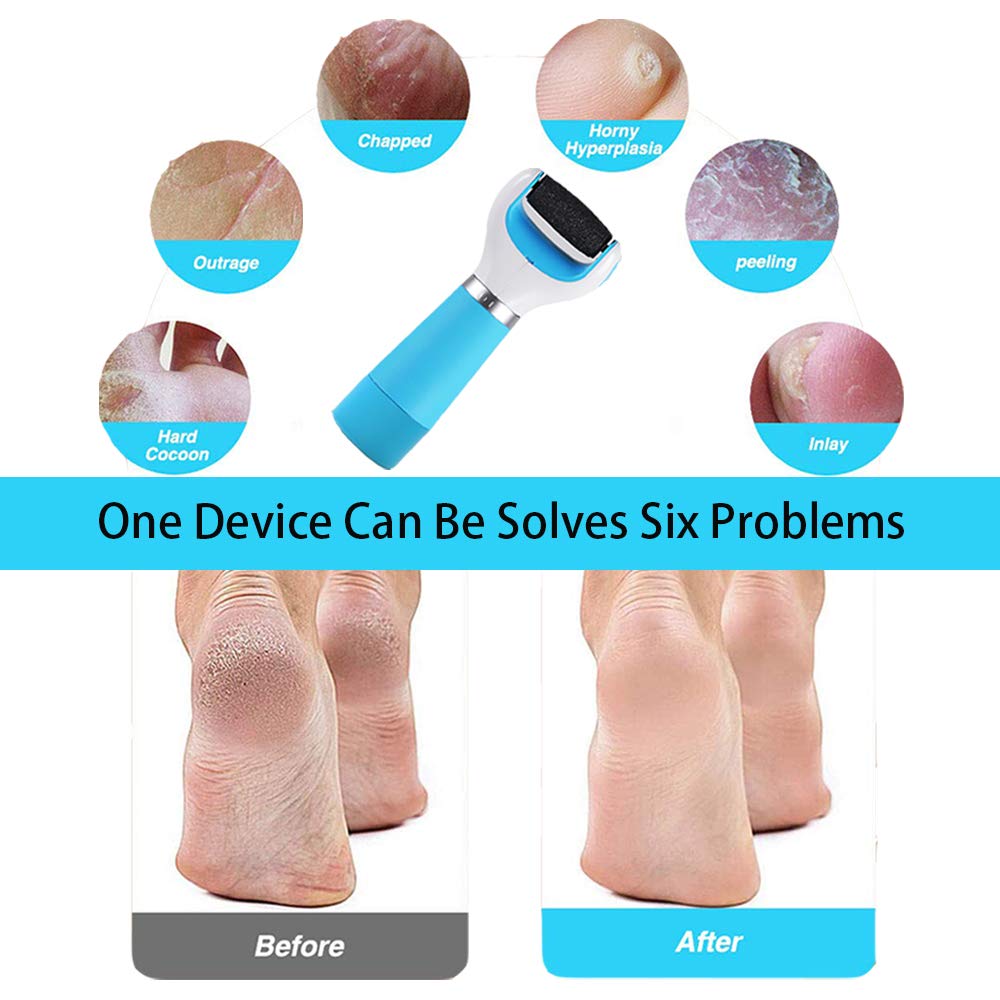 ELECTRIC RECHARGEABLE CALLUS REMOVER PEDICURE WITH ADJUSTABLE SPEEDS ...